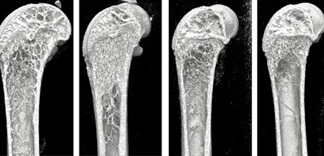 Balancing between build-up and break-down of bone - ResOU